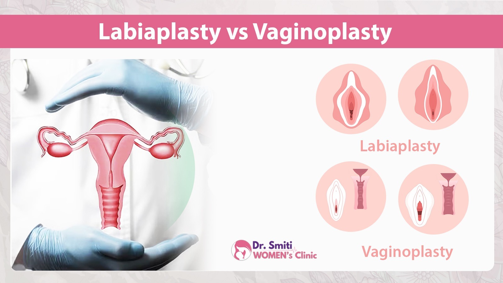 The Key Differences Between Labiaplasty And Vaginoplasty The Key Differences Between Labiaplasty And Vaginoplasty